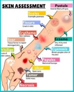 Understanding Your Skin: Key Dermatology Terms